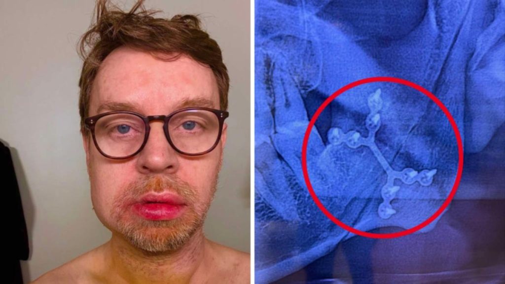 Aussie musician Darren Hayes reveals he ‘nearly died’ after suffering ...