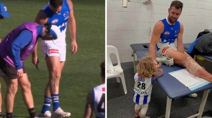 Growing ‘concern’ around AFL players’ boots in wake of gruesome injury ...
