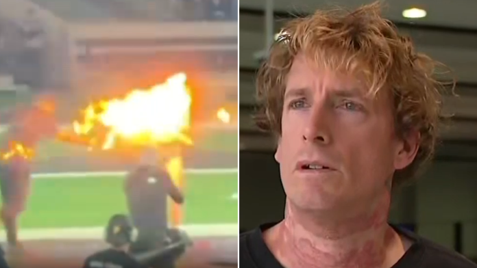 Prankster badly burned in stunt gone wrong at Nitro Circus show at ...