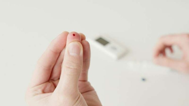 Simple finger-prick blood test could make early detection of Alzheimer ...
