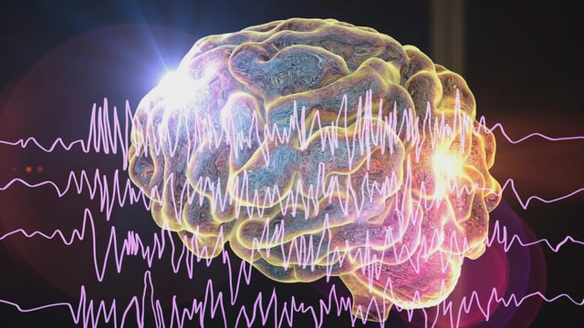 Gene-Targeting Therapy Delivers Stunning 91% Seizure Reduction in Kids ...