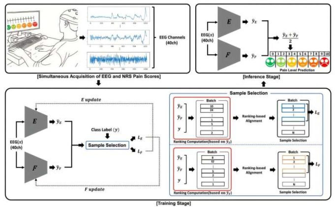 Researchers develop world's first AI for objective pain assessment ...
